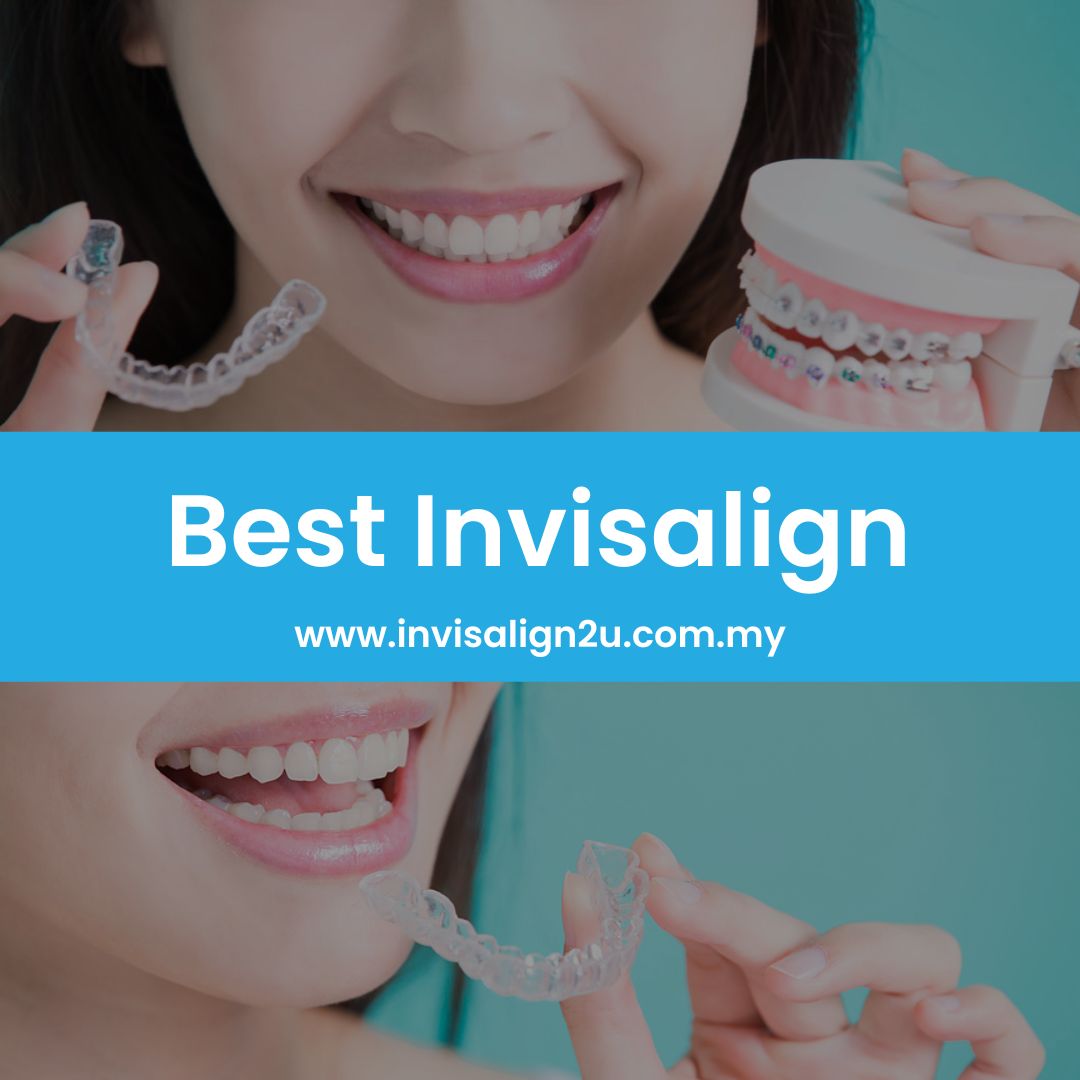 Invisalign Sentul - Best Invisible Braces in September 2025